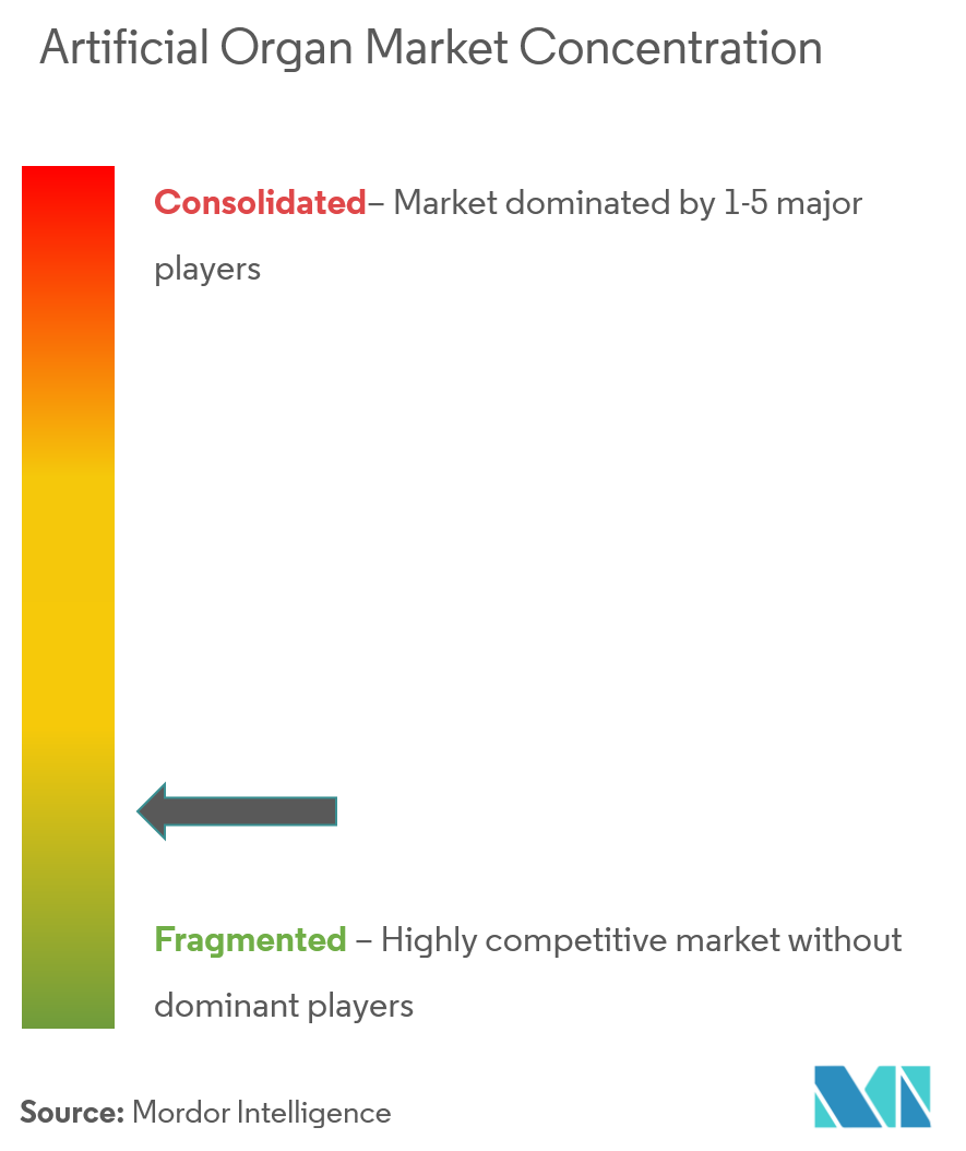 Global Artificial Organ Market | 2022 - 27 | Industry Share, Size ...